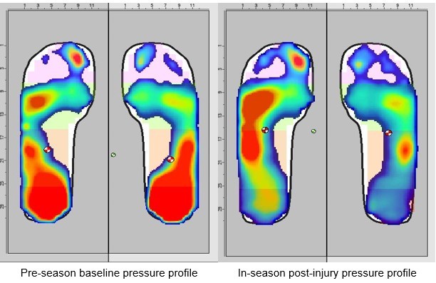 Profile Team Sport Players with Plantar Pressure Mapping Tech